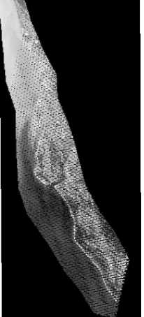 Is it possible to remove the scan-line error strip... - Esri Community